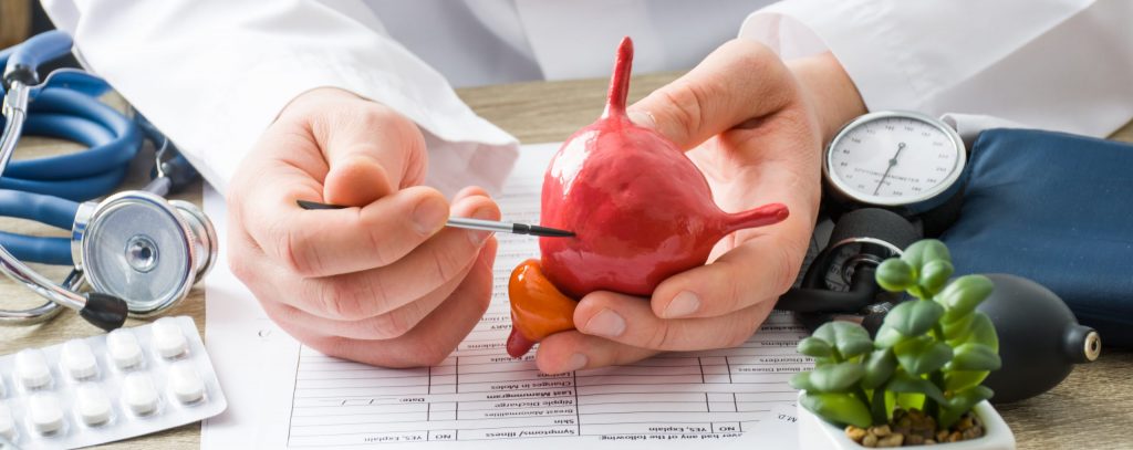 TTNS for Overactive Bladder - Opis Supplies